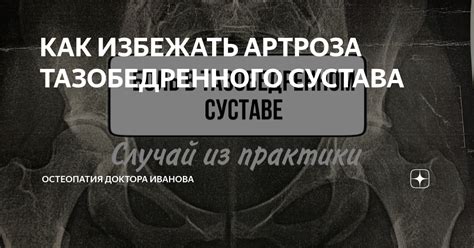 КАК ИЗБЕЖАТЬ АРТРОЗА ТАЗОБЕДРЕННОГО СУСТАВА Остеопатия доктора