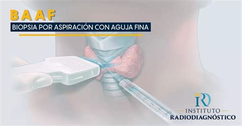 Alaska Comparar En particular baaf biopsia por aspiración con aguja fina Reembolso motor cápsula