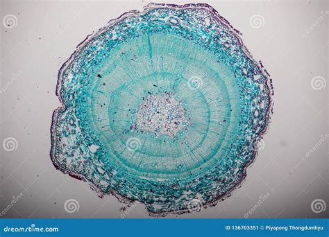 Cross Section Dicot Monocot And Root Of Plant Stem Under The