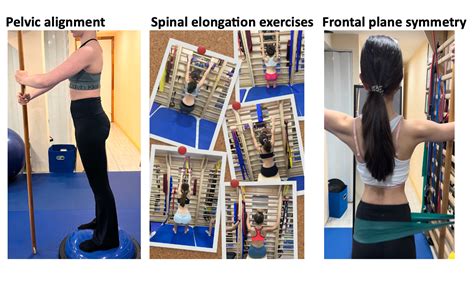 Schroth Method Brooklyn Scoliosis Therapy