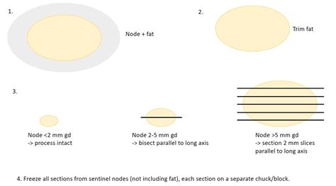 Sentinel Lymph Nodes For Handn Squamous Cell Carcinoma Gross Pathology