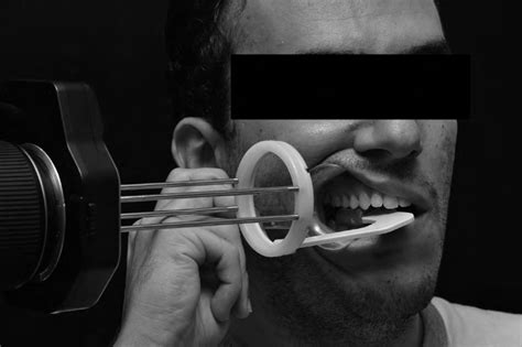View Of The Standardizing Deviceradiographic Positioner With Occlusal