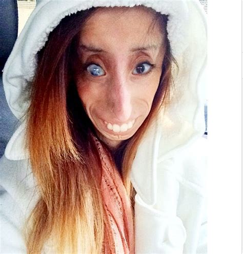 Official Blog Of Amaka Nwachukwu Meet 25 Year Old Lizzie Velasquez Who