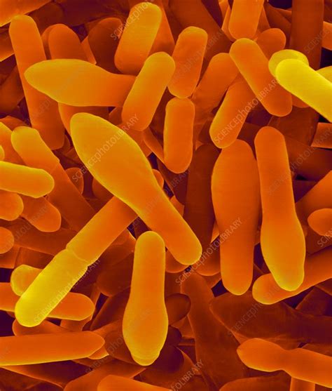 Clostridium Sporogenes Spore Forming Sem Stock Image C0322126