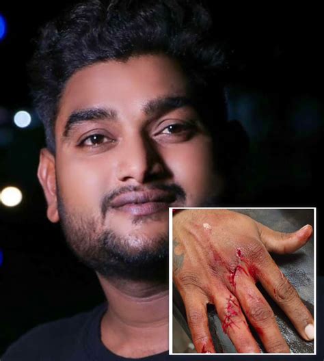 जगराता कार्यक्रम मे हुआ वाद विवाद राकेश करन ने हँसिये से किया रविंद्र को लहूलुहान आधी रात की