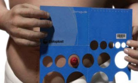 Как правильно измерить стому | Колопласт (Coloplast)