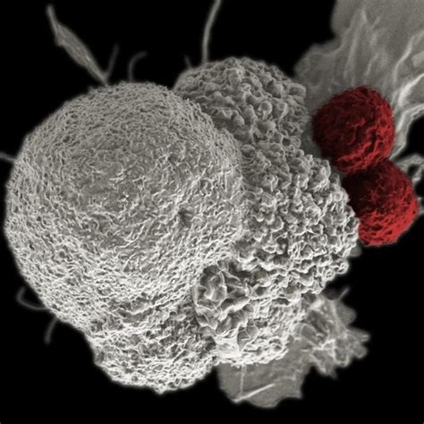 Pembrolizumab Approved As Standard First Line Therapy For Head And Neck