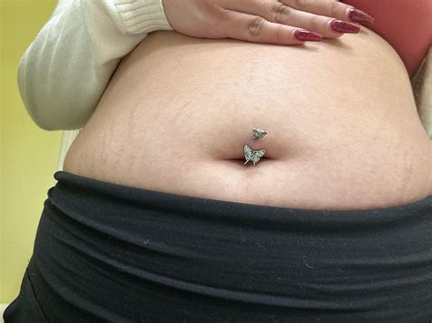 Is My Septum Infected I Got It Done 6 Days Ago No Major Pain No
