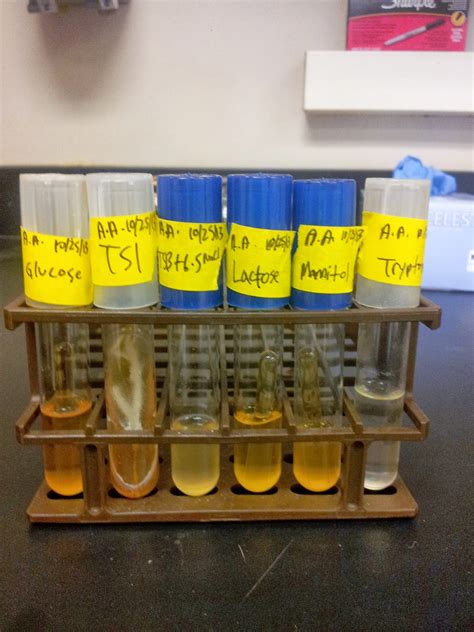 S Stem Scholar Alexis Almazan S Blog Staphylococcus Aureus New