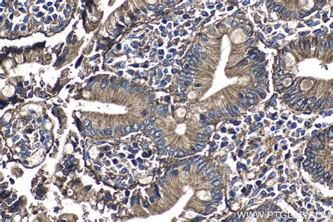 Cd151 Antibody 27816 1 Ap Proteintech