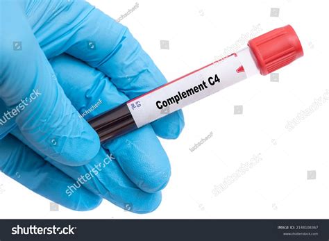 Complement C4 Medical Check Test Tube Stock Photo 2148108367 Shutterstock