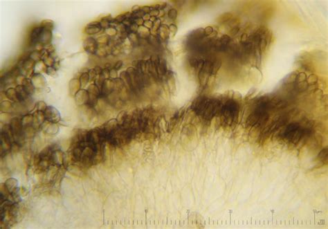 Vibrissea Flavovirens ヴィブリッセア フラヴォヴィレンス