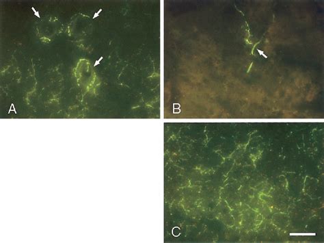 Figure 2 From Sympathetic Neural Control Of The Mouse Lacrimal Gland