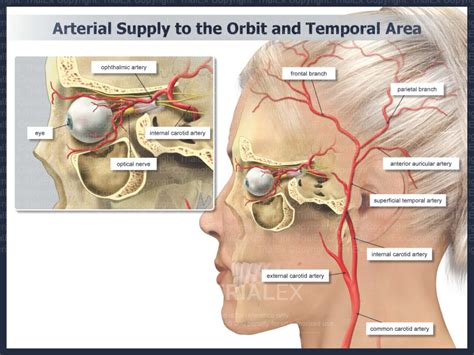 Ophthalmic Artery Dissection