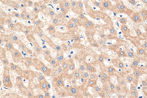 Inos Antibody 80517 1 Rr Proteintech