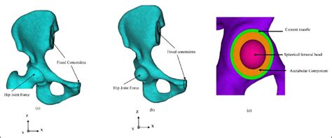 Finite Element Model Of Pelvic Bones A Intact Pelvic Bone B