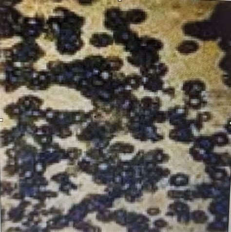 How To Prevent Damp And Mould From Growing In Your Home HubPages