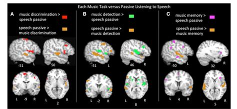 Figure 4 From The Relationship Between The Neural Computations For Speech And Music Perception