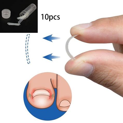 Oral Antibiotics For Ingrown Toenail