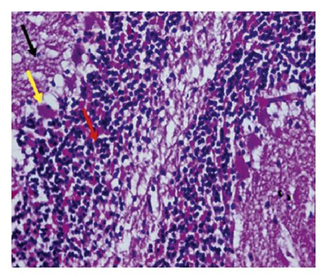 Brain Section Of Normal Control Group Showed The Cerebellum Showed