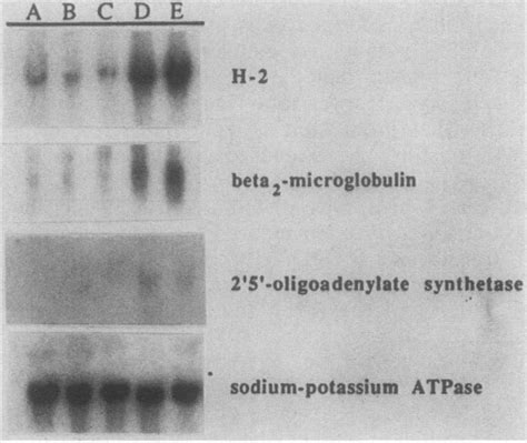 Effects Of Serum Deprivation On Mhc Class I Beta2 Microglobulin And