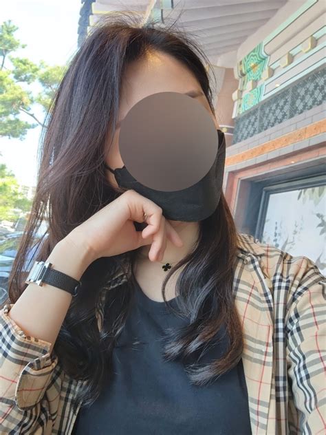 압구정로데오 피부과에서 골드ptt 1회만으로도 여드름 효과 본 후기 네이버 블로그