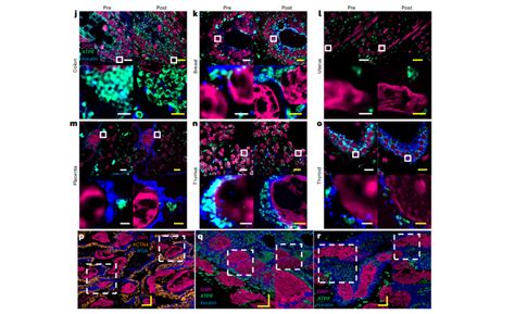 Mmi Member Yongxin Zhao Publishes Manuscript On Expansion Microscopy In