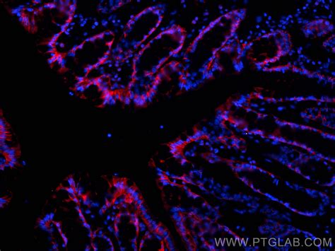 Multi Rab™ Coralite® Plus 594 Goat Anti Rabbit Recombinant Secondary