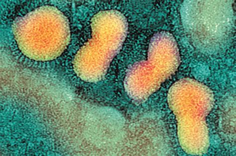 Bird Flu Case Reported On Scottish Poultry Farm The Pharmaceutical