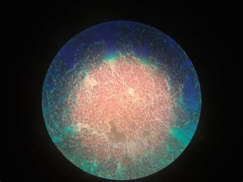Mis Eritrocitos Tomada Del Microscopio Durante La Practica… Flickr