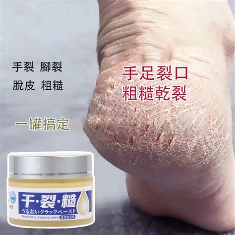 乾裂剋星 手足皸裂膏防凍防裂手足護理霜脫皮保濕霜手裂腳裂乾裂膏粗糙皺裂膏呵護手足滋潤膏幹裂糙凍傷膏腳跟龜裂膏手足護理霜 蝦皮購物