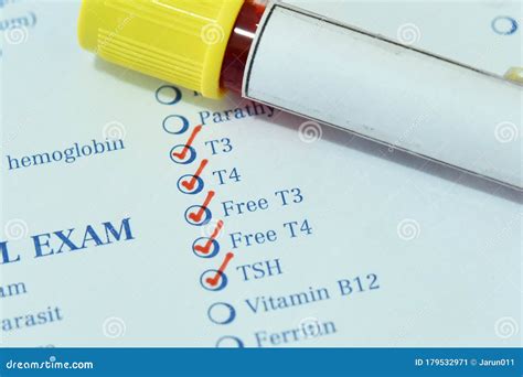 Thyroid Hormone Thyroxine Anatomical Volume Thyroid Gland Figure Lies