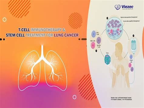 T Cell Immunotherapy And Stem Cell Treatment For Lung Cancer