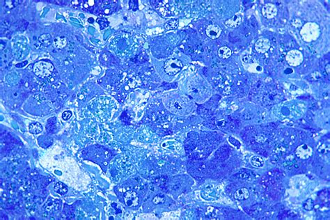 Free Picture Photomicrograph Shows Hepatitis Lassa Virus