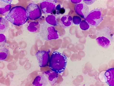 Proerythroblast