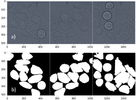 Deep Learning Based Bio Medical Image Segmentation Using Unet