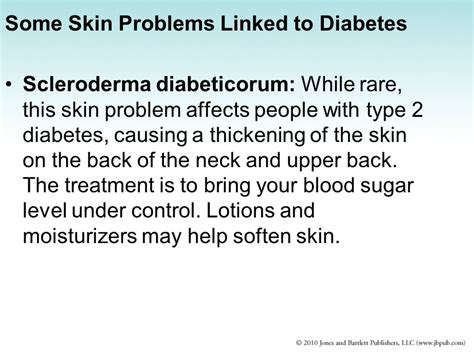 Chapter 22 The Pancreas And Diabetes Mellitus Ppt Download