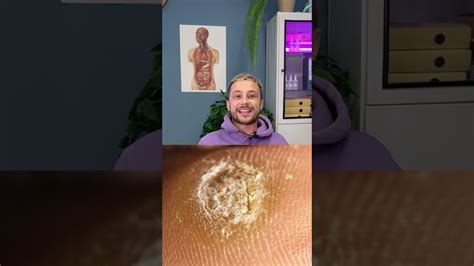 Papillock: цена, реальные отзывы, инструкция по применению, состав
