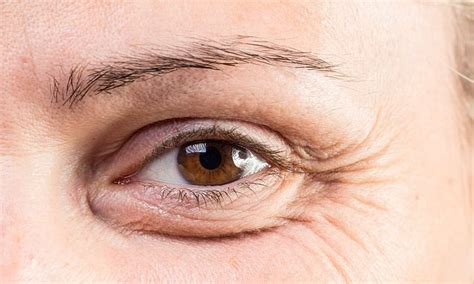 The Gene Injection To Stop Sight Loss In Ageing Eyes Daily Mail Online
