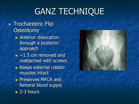 Ppt Surgical Hip Dislocation Powerpoint Presentation Id3258313