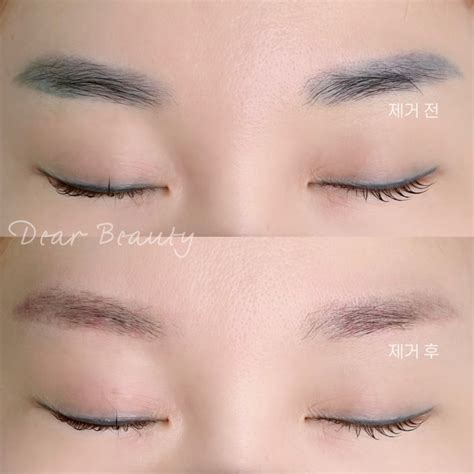 울산 상처없는 눈썹문신 제거 반영구 제거 잘하는곳 양산 눈썹 잔흔 제거 경주 눈썹문신 제거 맛집 푸른눈썹 제거 붉은눈썹문신 제거 아이라인 제거 울산 토탈뷰티샵