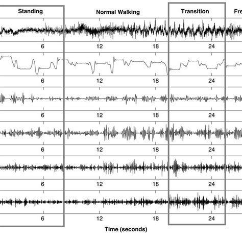Decomposition Of Eeg Into Detail D1 D5 Signals Related To Five Download Scientific Diagram