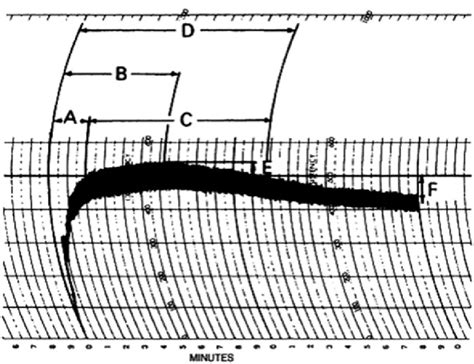30 Typical Farinograph Curve A Arrival Time B Peak Time C