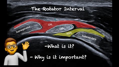 The Rotator Interval What Is It And Why We Need To Know About It