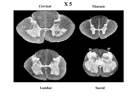 PPT Cortex Cingulate Gyrus Precentral Gyrus Postcentral Gyrus Primary Visual Cortex