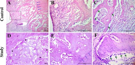 Light Micrographs Lm Of Hande Stained Decalcified Sections A And D