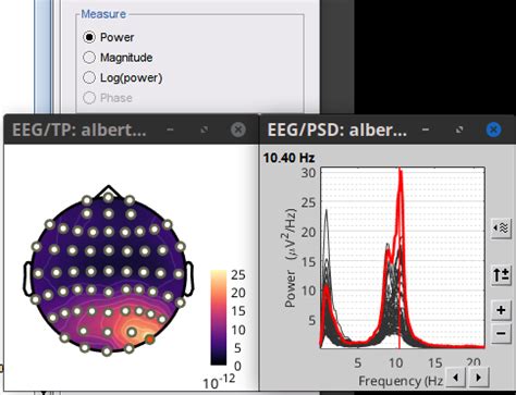EEG Chan Locs For Source Analysis Discussions Brainstorm