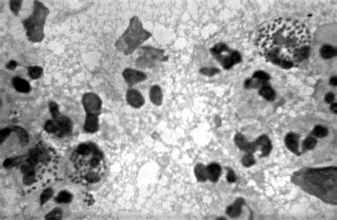 Free Picture Photomicrograph Intracellular Neisseria Gonorrhoeae