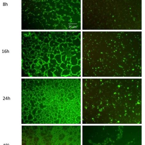 Impact Of F1 On Biofilm Phenotype In P Aeruginosa Pao1 Download
