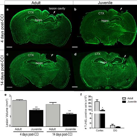 Analysis Of Cortical Lesion Volume And Cell Death After Cci Injury Download Scientific Diagram